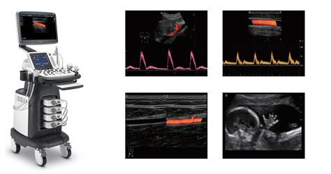 Máy Siêu âm Màu 5d Sonoscape M22 Phú Việt Medical Là Nhà Phân Phối Chính Hãng Dòng Sonoscape