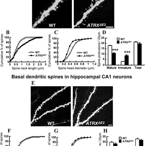 Abnormal Basal Dendritic Spines In The Mpfc But Not In The Hippocampal