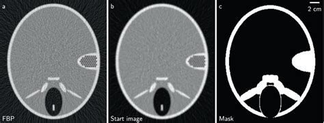 a filtered backprojection fbp b start image for the iterative