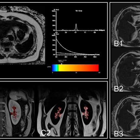 Box Plots Illustrating The Distribution Of Adipose Tissue Depots