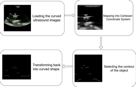 Ultrasound Processing Package — Ultrasound Processing Documentation