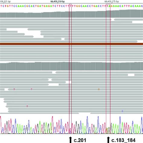 Aligned Ngs Reads From Wes Data Top And Sanger Sequencing Peak Map Download Scientific