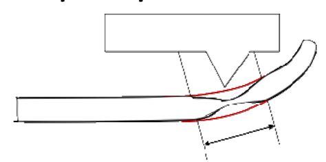 Figure 4 Ascending Urethrogram And Sonourethrogram In