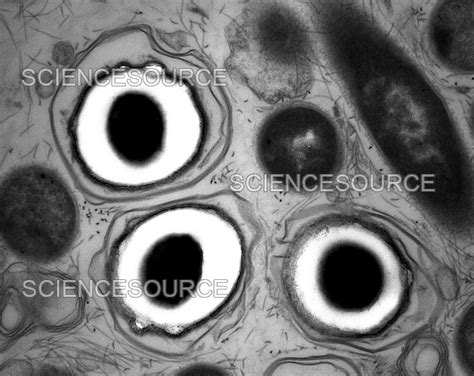 Endospore In Bacteria