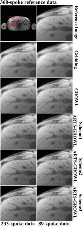 Comparison Of Convolution Gridding Growl And Arts Growl For Download Scientific Diagram