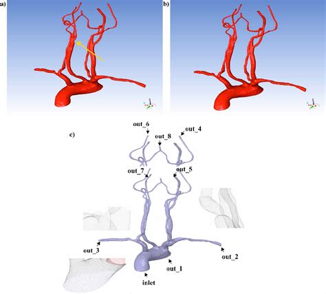 Figure 3 From Computational Fluid Dynamics As An Engineering Tool For