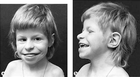 Figure 1 From The Application Of Region Specific Probes For The Resolution Of Duplication 8p A