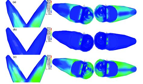 The Von Mises Stress Contours Of The A Elasto Plastic B Download Scientific Diagram