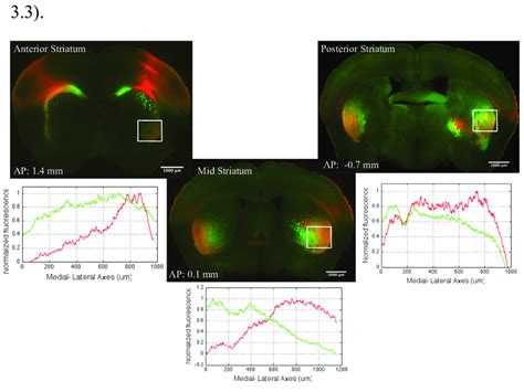 1 Primary And Secondary Orofacial Motor Cortices Projected On Download Scientific Diagram
