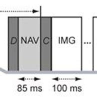 Triggered Pulse Sequence TD Delay To Start Of Diastole D Dummy Download Scientific Diagram