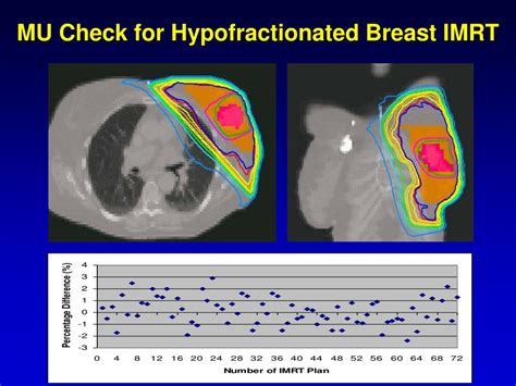 Ppt Independent Dose Verification For Imrt Using Monte Carlo Powerpoint Presentation Id4159165