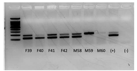 One Sample Is Not Amplified In Pcr Genotyping What Could Be The Reason