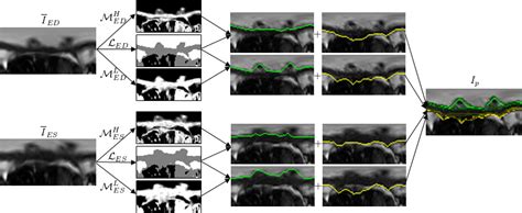 Segmentation Of The Average Images To Generate Multiple Candidate Download Scientific Diagram