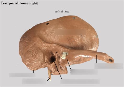 Temporal Bone Right Lateral View Diagram Quizlet