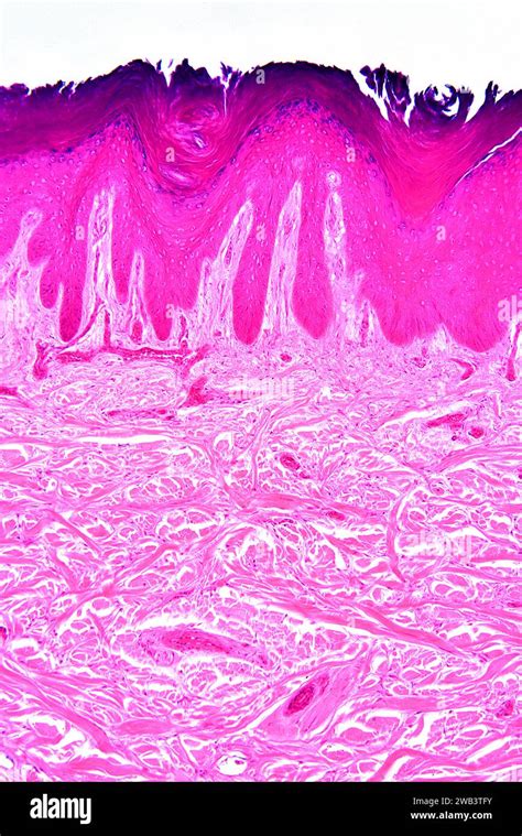 Nonkeratinized Stratified Squamous Epithelium Of The Human Esophagous