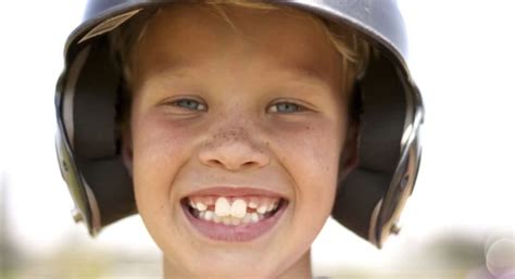 Buck Teeth Causes Effects Treatment Options And Costs