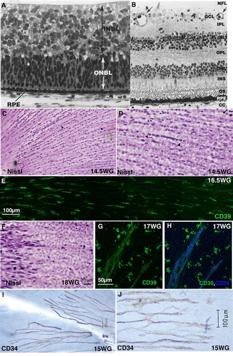 A B Developing Human Retina From An Avascular Undifferentiated
