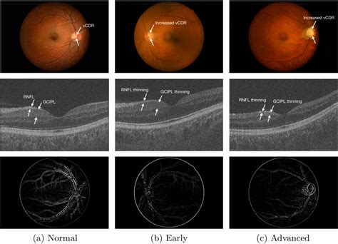 [论文审查] Etscl An Evidence Theory Based Supervised Contrastive Learning Framework For Multi Modal