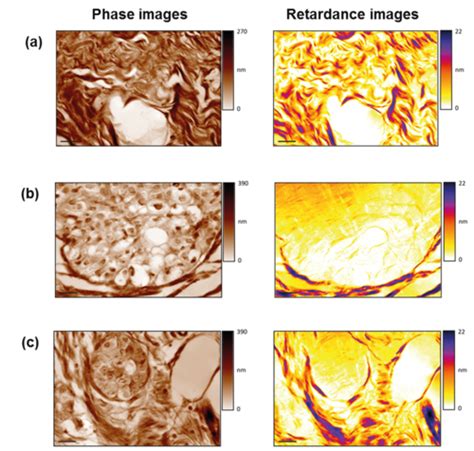 定量相位成像 Phasics