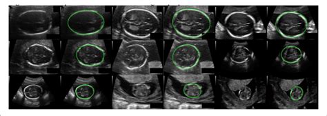 Some Examples Of Detection Results Using The Proposed Method Download Scientific Diagram