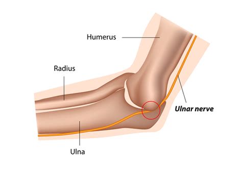 Ulnar Nerve Decompression Surgery Mr Jagwant Singh