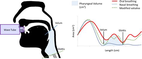 Schematic Of Process For Capturing Pharyngeal Volume Using Acoustic Download Scientific Diagram