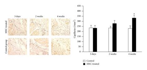 Cardiomyocytes Apoptosis And Capillary Density In Peri Infarct Area