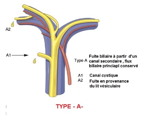 A Le Type A De La Classification De Hannover Download Scientific Diagram