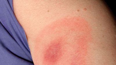 Conditions And Diseases Portal Britannica