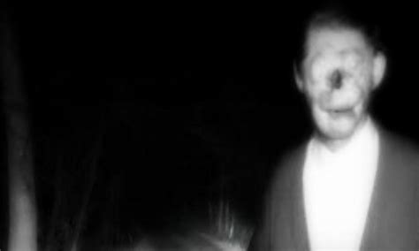 The Terrifying True Story That Inspired The Charlie No Face Urban Legend