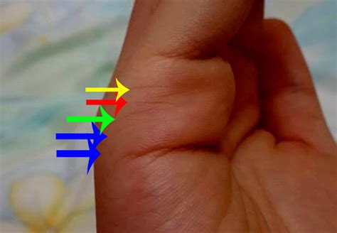 Хиромантия Линия Брака С Разъяснениями Фото —