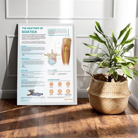 The Anatomy Of Sciatica Poster Nerve Pain And Spine Chart Anatomystuff