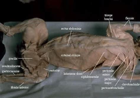 Rectus Abdominis Cat Muscle