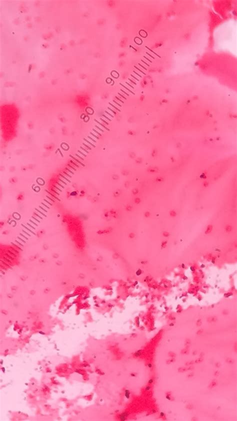 Streptococcus Pyogenes Capsule Stain Microbiology Abstract Artwork