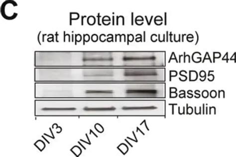 单克隆抗 β 微管蛋白 Ⅲ神经元 小鼠抗，anti β Tubulin Iii Neuronal Antibody Mouse