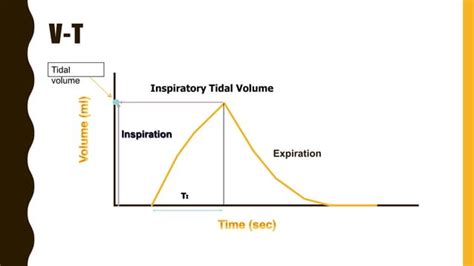 Ventilator Graphics That Shows Scalar And Loops Pdf