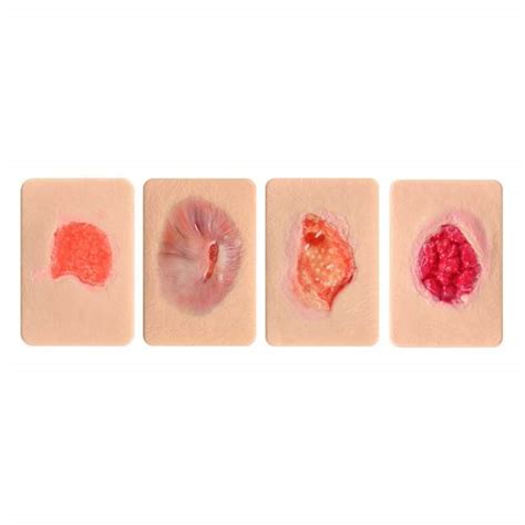 Pocket Granulation Tissue Wound Model Set For Wound Care Education