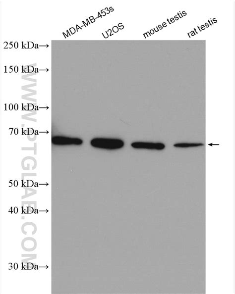 Plk1 Antibody 10305 1 Ap Proteintech