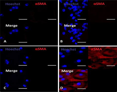 Figure 2 From Spatiotemporal Delivery Of Basic Fibroblast Growth Factor To Directly And