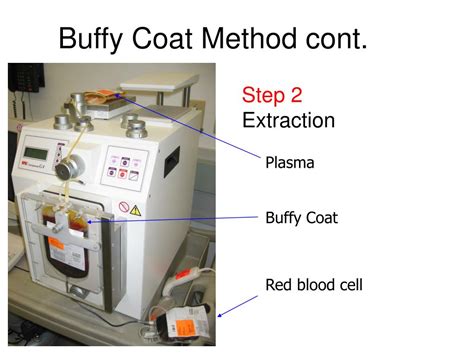 Ppt Buffy Coat Method Powerpoint Presentation Free Download Id 4294715