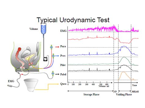 Urodynamics And Neuro Urology Urology Malaysia