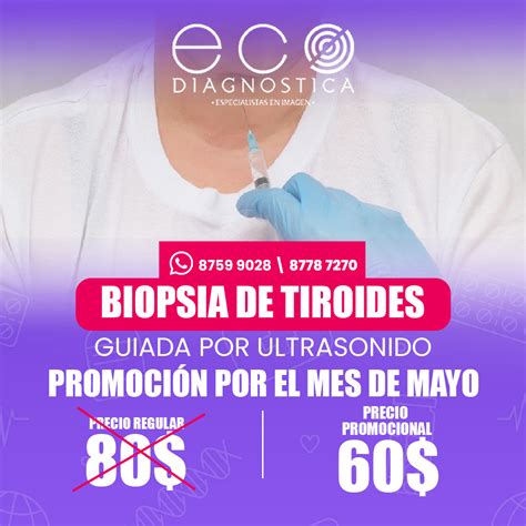 Ecodiagnostica Biopsia De Tiroides 🚨la Biopsia De
