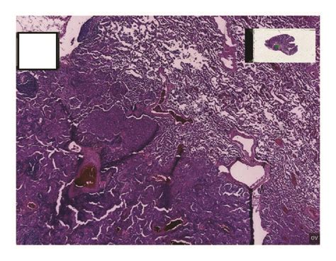 Low Power Overview Showing Dip And Rb Ild With Adjacent Normal But