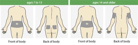 Inserting Starting Your Guardian Sensor MiniMed 780G System Support Medtronic
