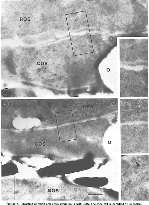 Figure 5 From An Electron Microscope Analysis Of Cross Linked Albumin Embedded Semantic Scholar