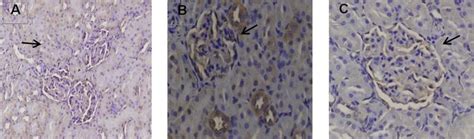 Expression Of Ed1 Positive Cells In Renal Tissue A Control Without Download Scientific
