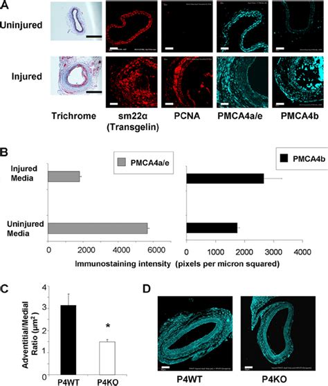 Immunofluorescence Based Quantification Revealed Regulated Pmca4 Download Scientific Diagram