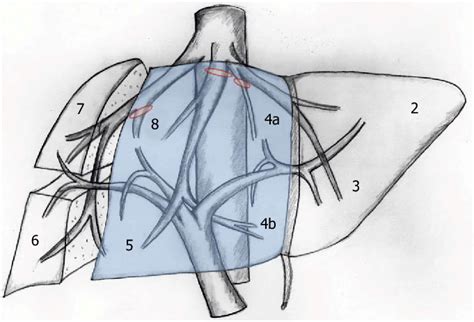 Central Hepatectomy Segment Orientated Resection Couinaud Segments Are