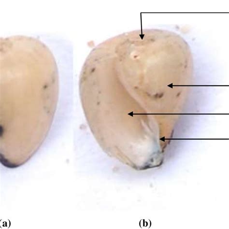 Abapertural A And Apertural B View Of Bulinus Globosus X3 The