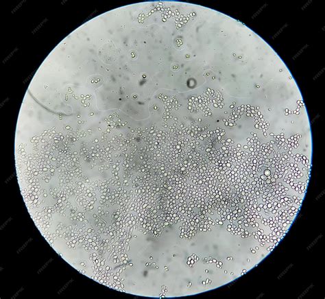 Bakers Yeast Microscope